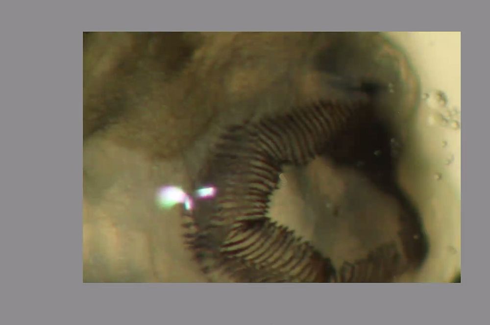 Kriebelmücken – Homepage der Tübinger Mikroskopischen Gesellschaft e. V.