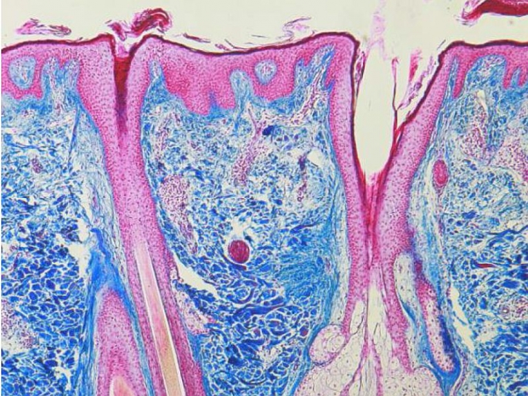 Die Körperhaut – Histologie, Funktion und Lebensraum von Parasiten ...
