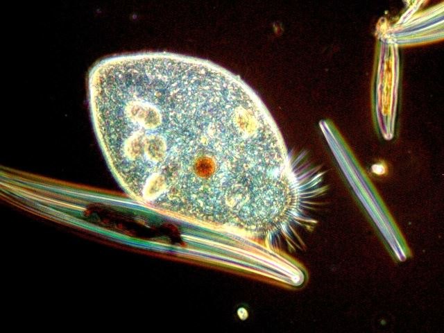 Wimpertierchen (Strobilidium) – Homepage der Tübinger Mikroskopischen ...